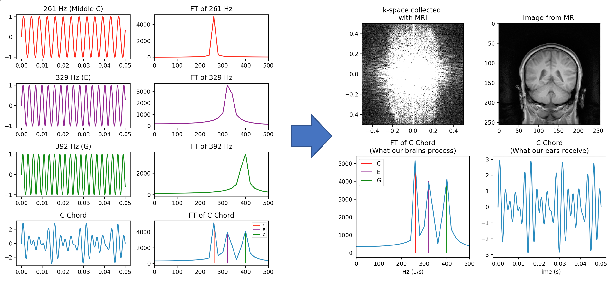 MRI Fourier Space – Mira M. Liu